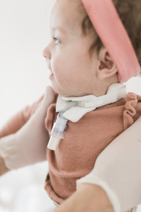 Tracheostoma bei Kindern -Informationen f. Eltern und Pflege